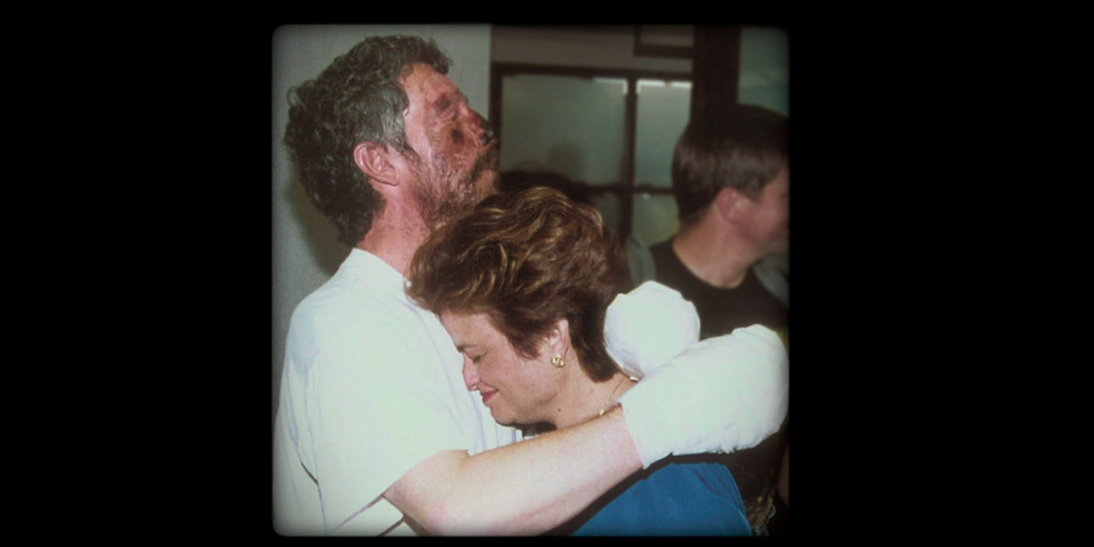 Beck Weathers: Where is the Everest Tragedy Survivor Today?