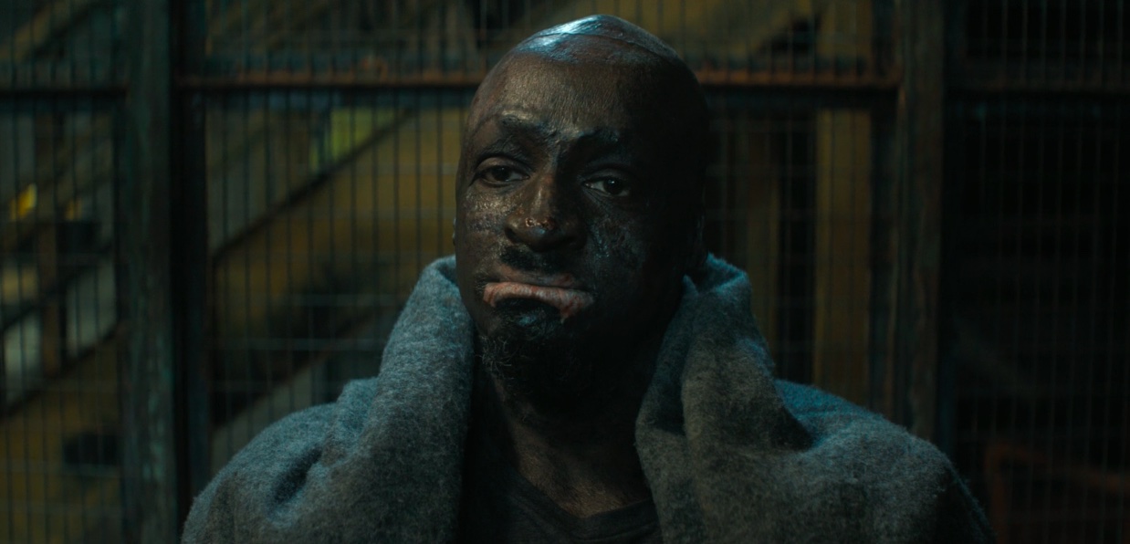 Who is Henry Sickler? What Happened to His Face and Hands? Who Plays Him?